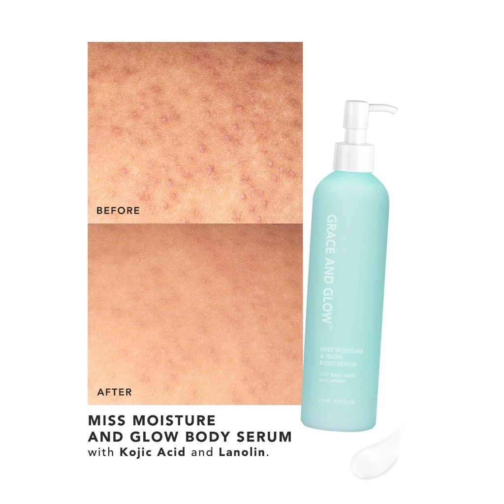 7 Rekomendasi Grace and Glow Body Serum Terbaik | mybest
