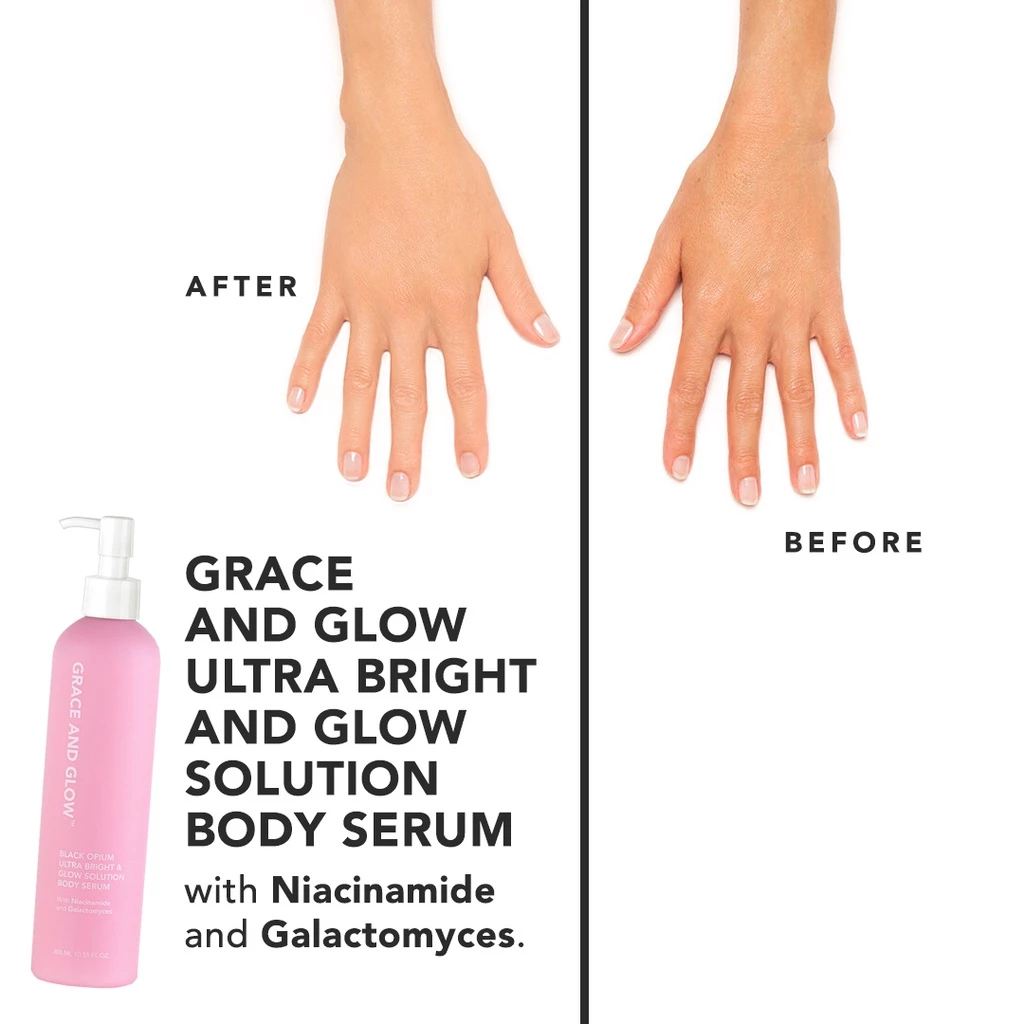 7 Rekomendasi Grace and Glow Body Serum Terbaik | mybest